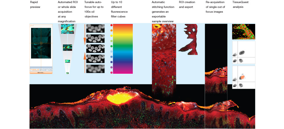 TissueGnostics 组织细胞定量分析系统_细胞分析系统_细胞分析_细胞生物仪器_高德真商城（goldengene.com）、品质保证、放心服务、轻松选购、仪器选型咨询、试剂耗材现货 ...
